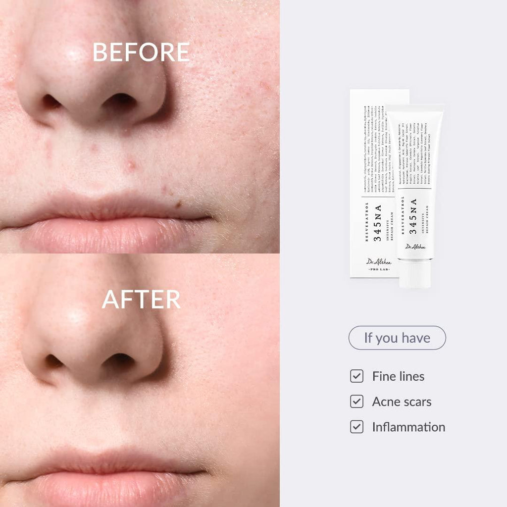 Dr.althea 345 relief cream | ColorShow