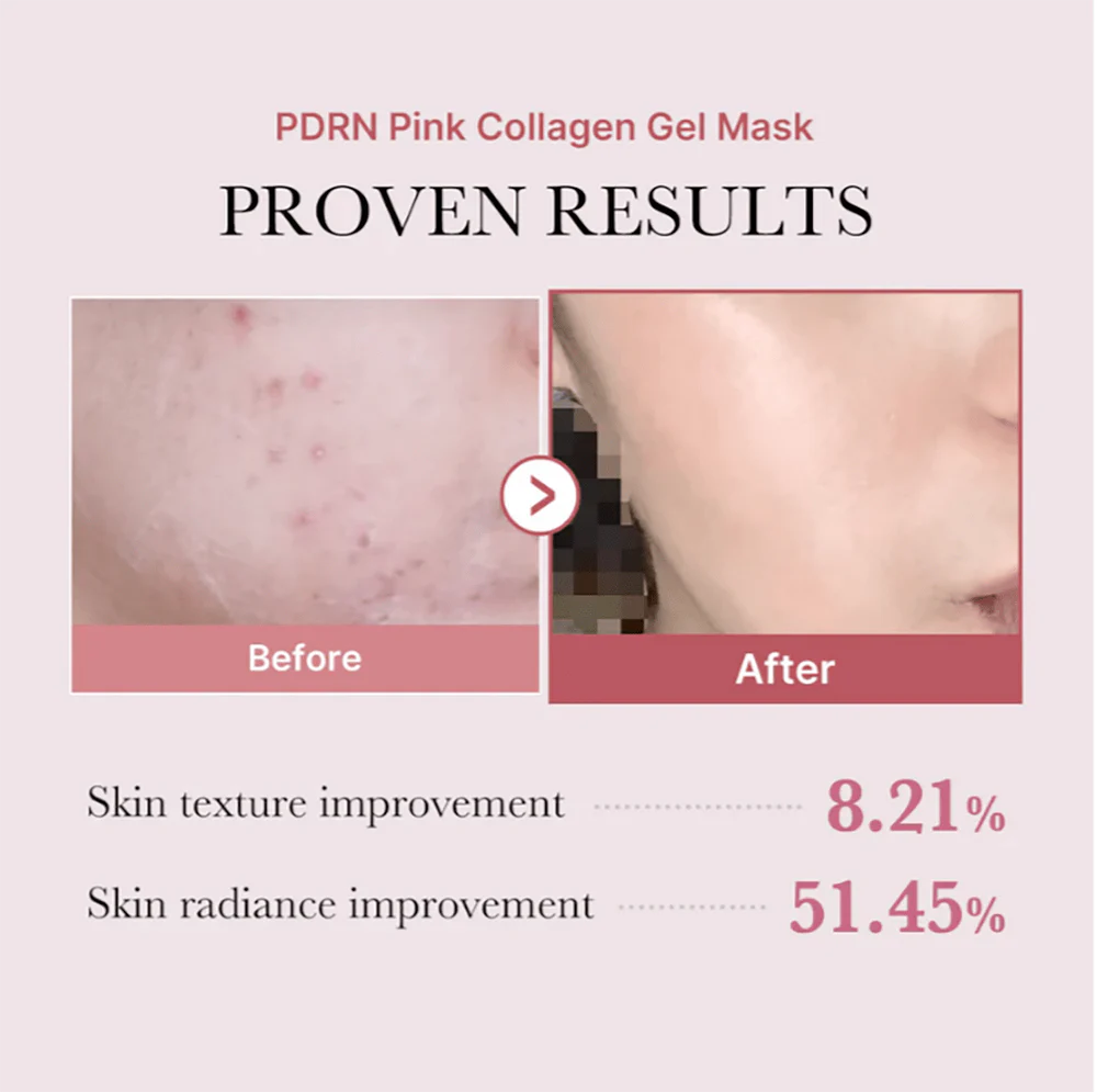 Medicube pdrn pink collagen gel mask (1ea) | ColorShow